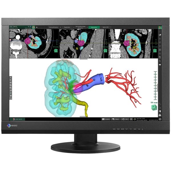 ARIA - Monitor Eizo medicale con curva DICOM da 24" e risoluzione 16:10